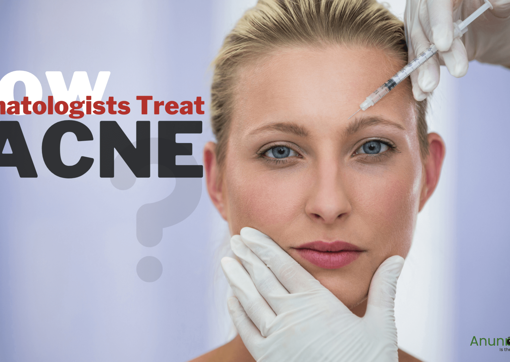 How Dermatologists Treat Acne?